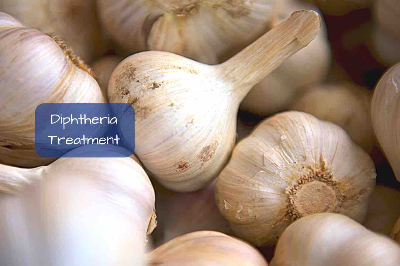 What Is Diphtheria? Is There An All-Natural Diphtheria Treatment?