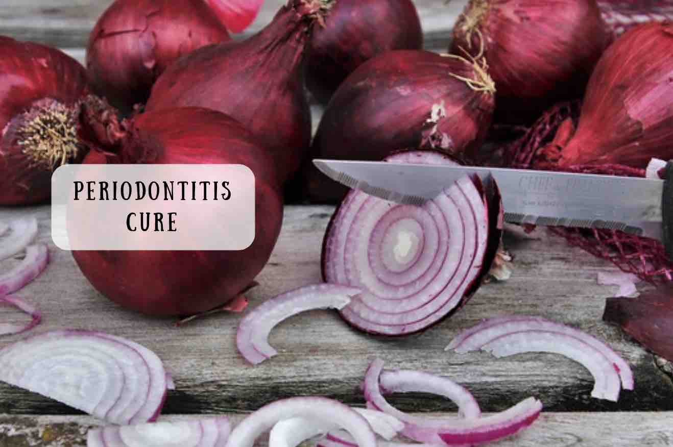 Periodontitis (Pyorrhea): Symptoms, Causes And Treatment