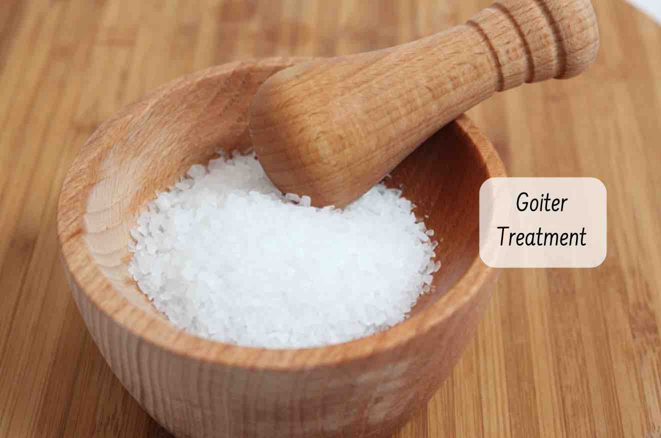 What Is Goiter disease? Is There An Ayurvedic Goiter Treatment?