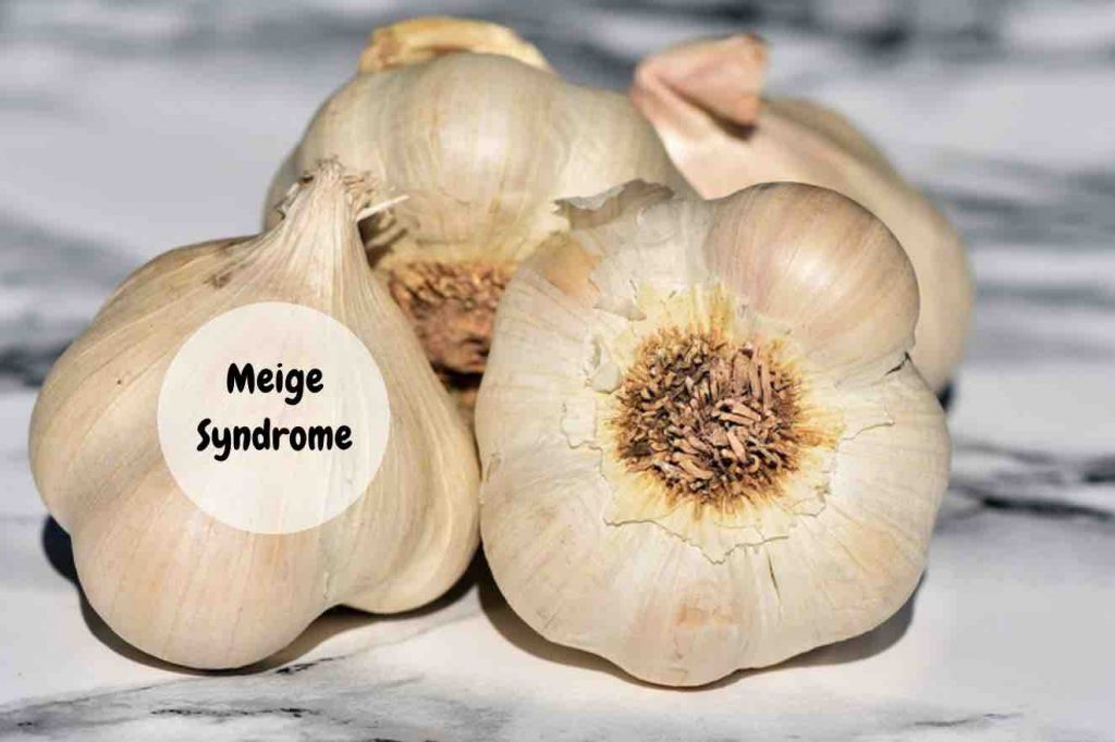 meige-syndrome - Ayurvedum
