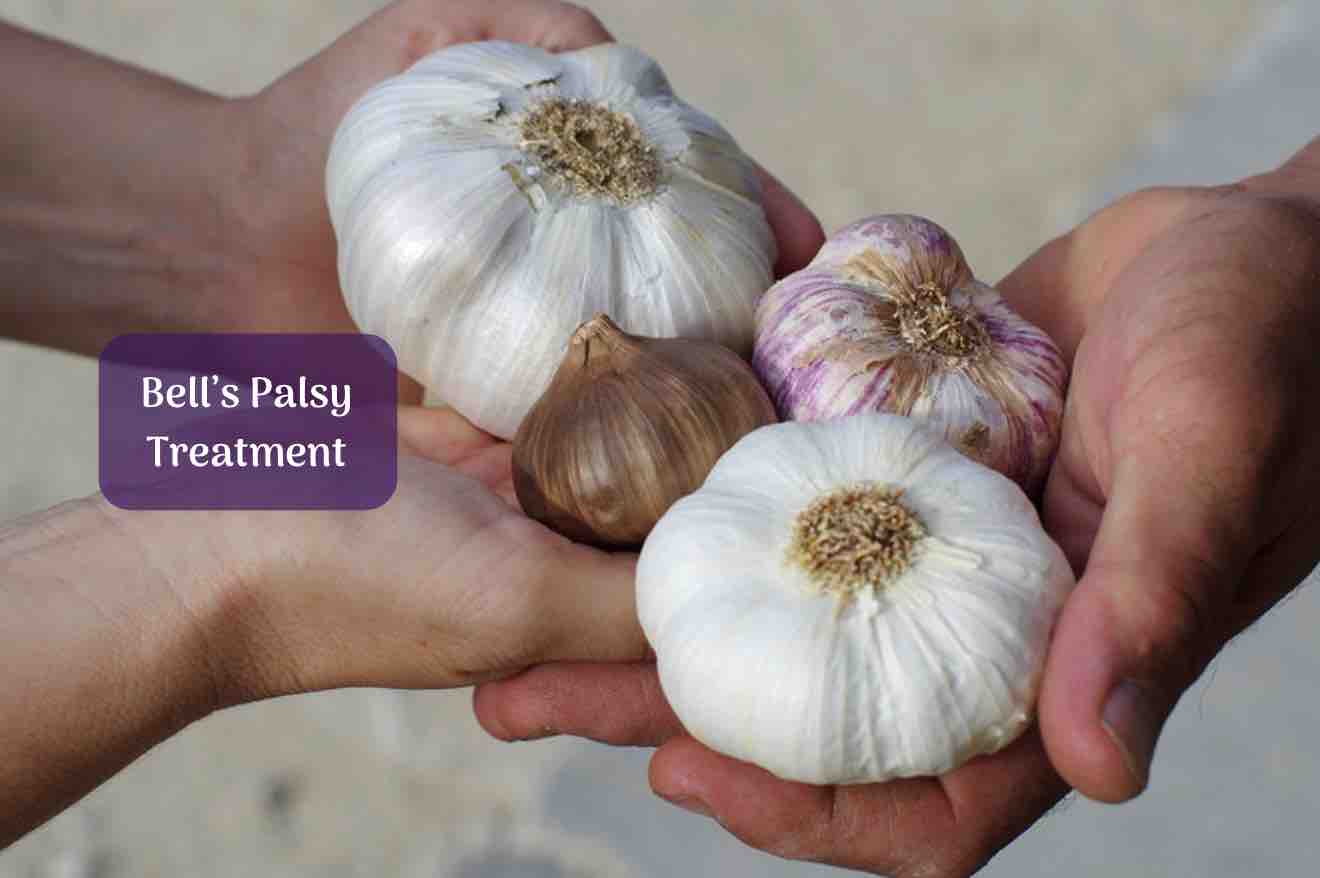 Bell’s Palsy - Here's An Effective Bell’s Palsy Treatment - Ayurvedum