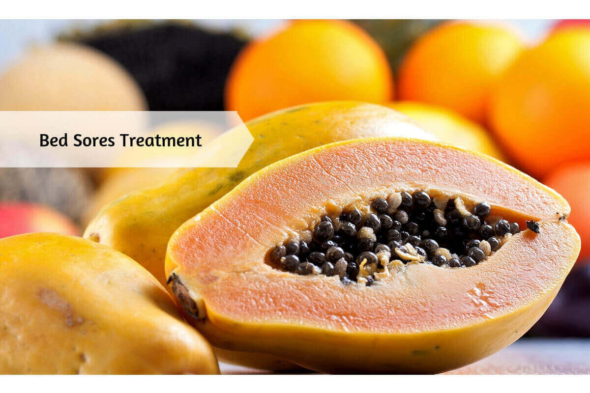 Bed Sores (Pressure Ulcers): Symptoms, Preliminary Care & Treatment