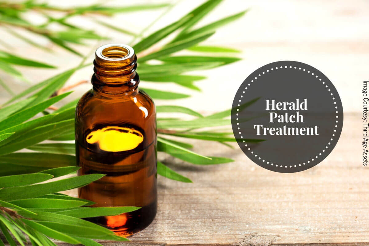 Herald Patch (Pityriasis Rosea) Treatment: 5 Effective Home Remedies