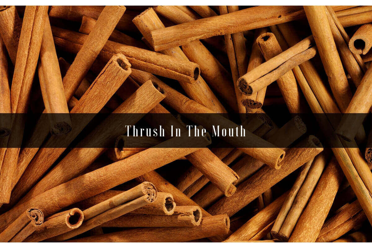 Thrush In The Mouth (Oral Candidiasis): Remedies For Total Healing